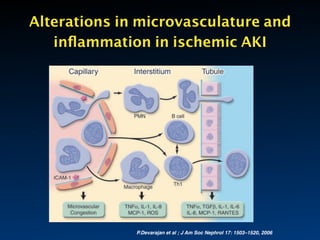 AKI pathophysiology chaken maniyan | PDF