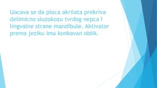 Akivator (monoblok).pptx