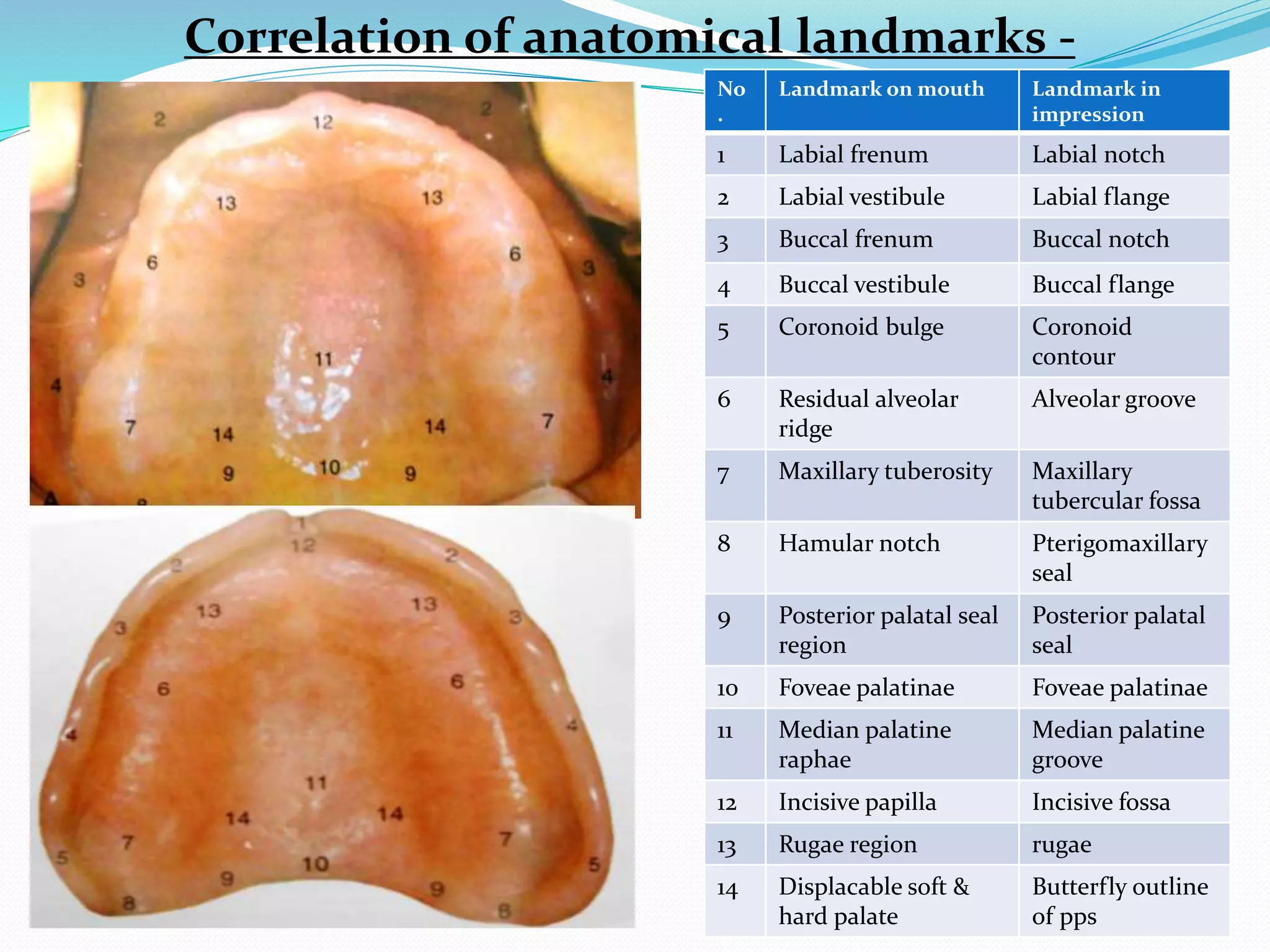 maxillary anatomical landmarks | PPTX