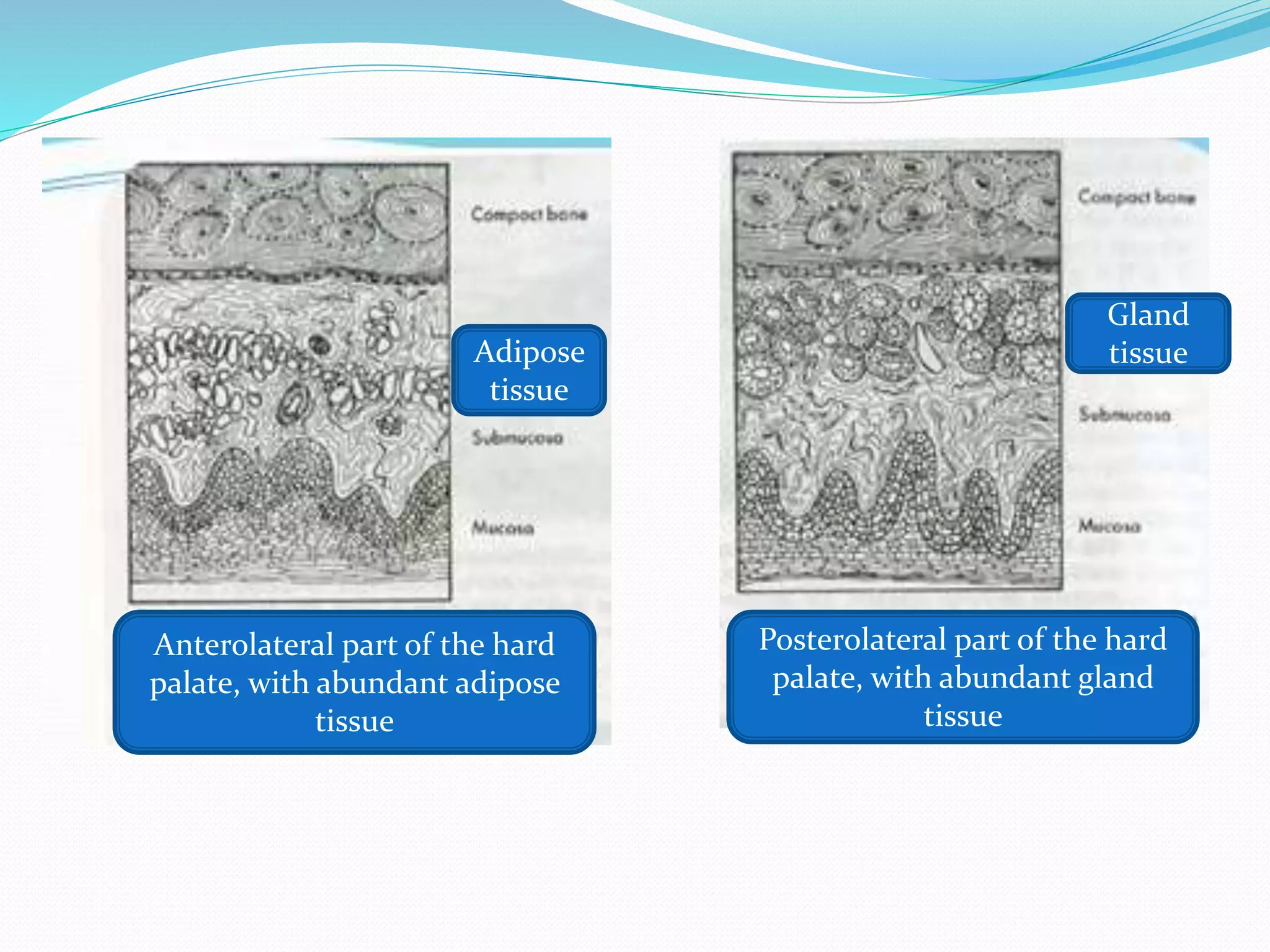 maxillary anatomical landmarks | PPTX