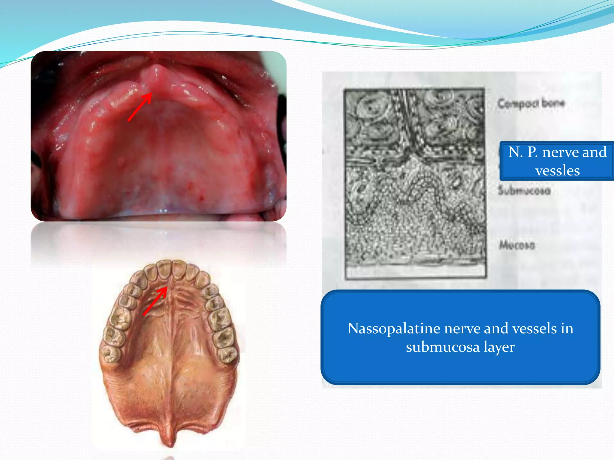 maxillary anatomical landmarks | PPTX