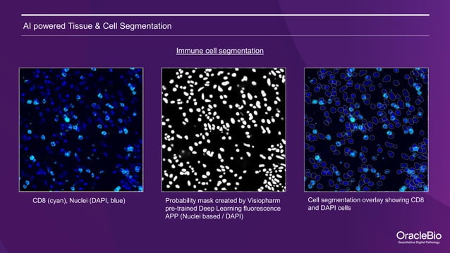 A Ready-to-Analyze High-Plex Spatial Signature Development Workflow for ...
