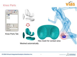 Knee Simulation using ABAQUS | PDF