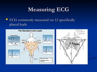 ECG Filtering Techniques And Methodologies | PPT