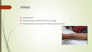 Akses Vaskular Dewasa dan Anak serta Tatalaksana Komplikasinya .ppt