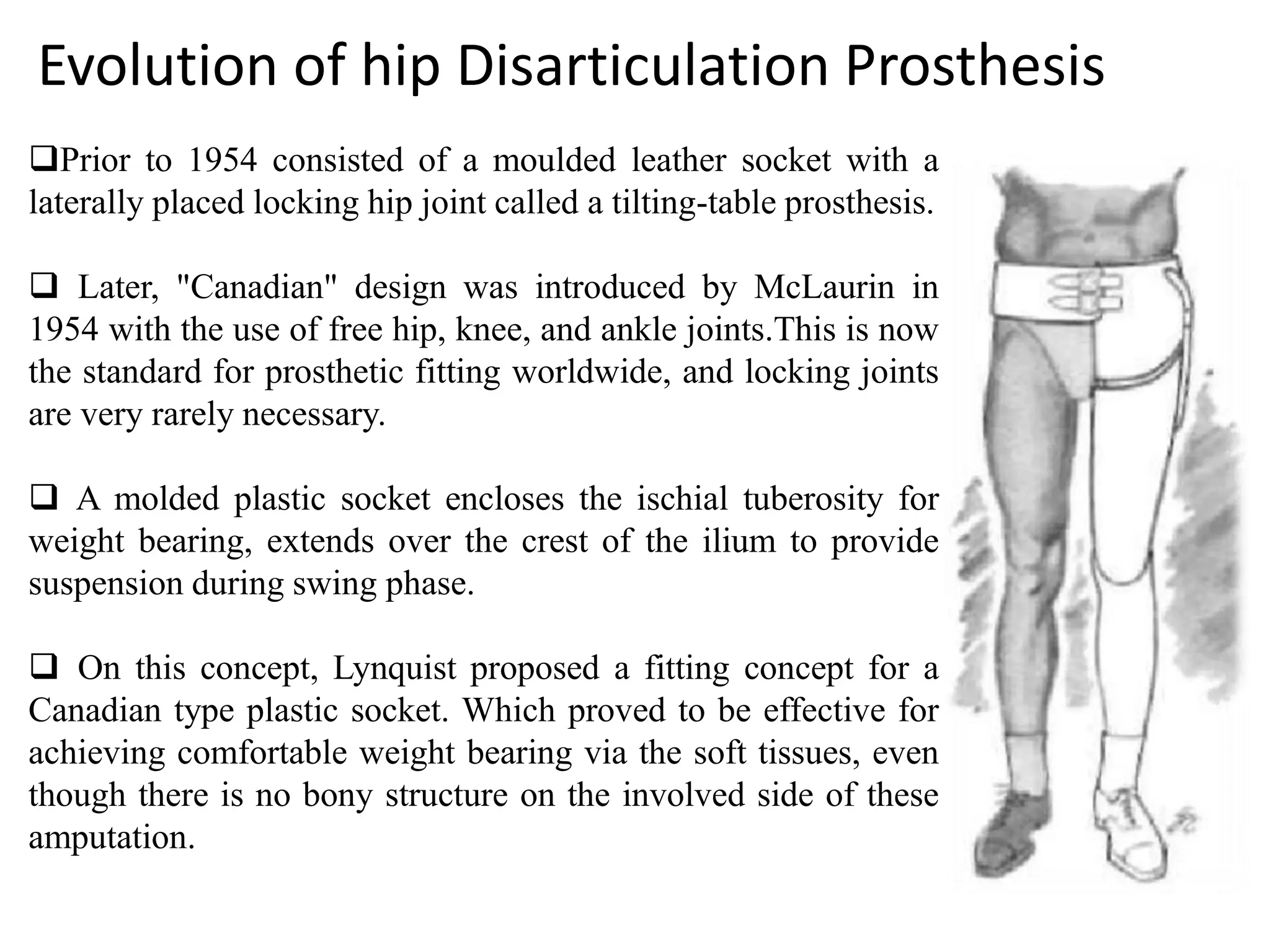 HIP DISARTICULATION | PPTX