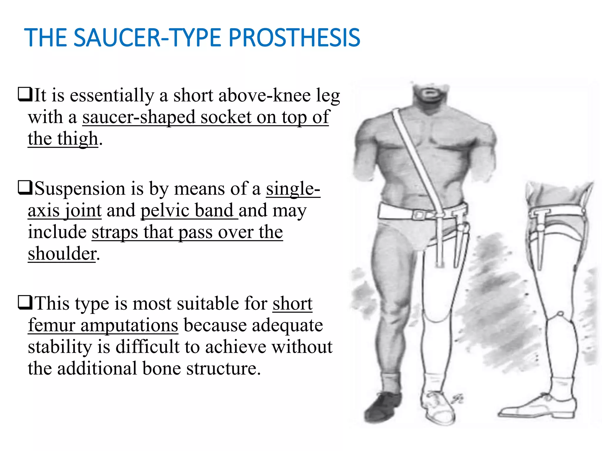 HIP DISARTICULATION | PPTX