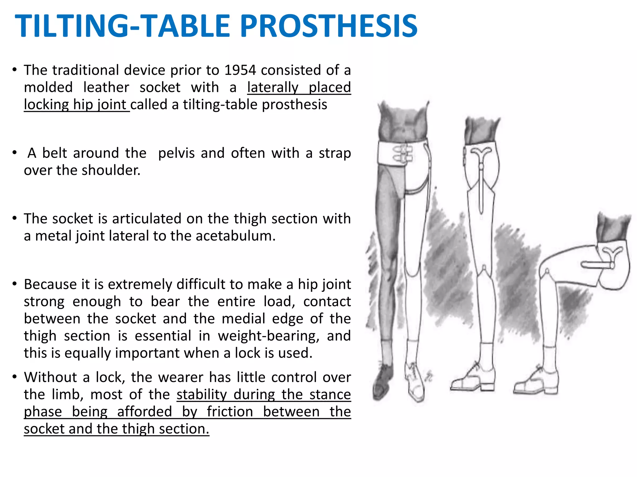 HIP DISARTICULATION | PPTX