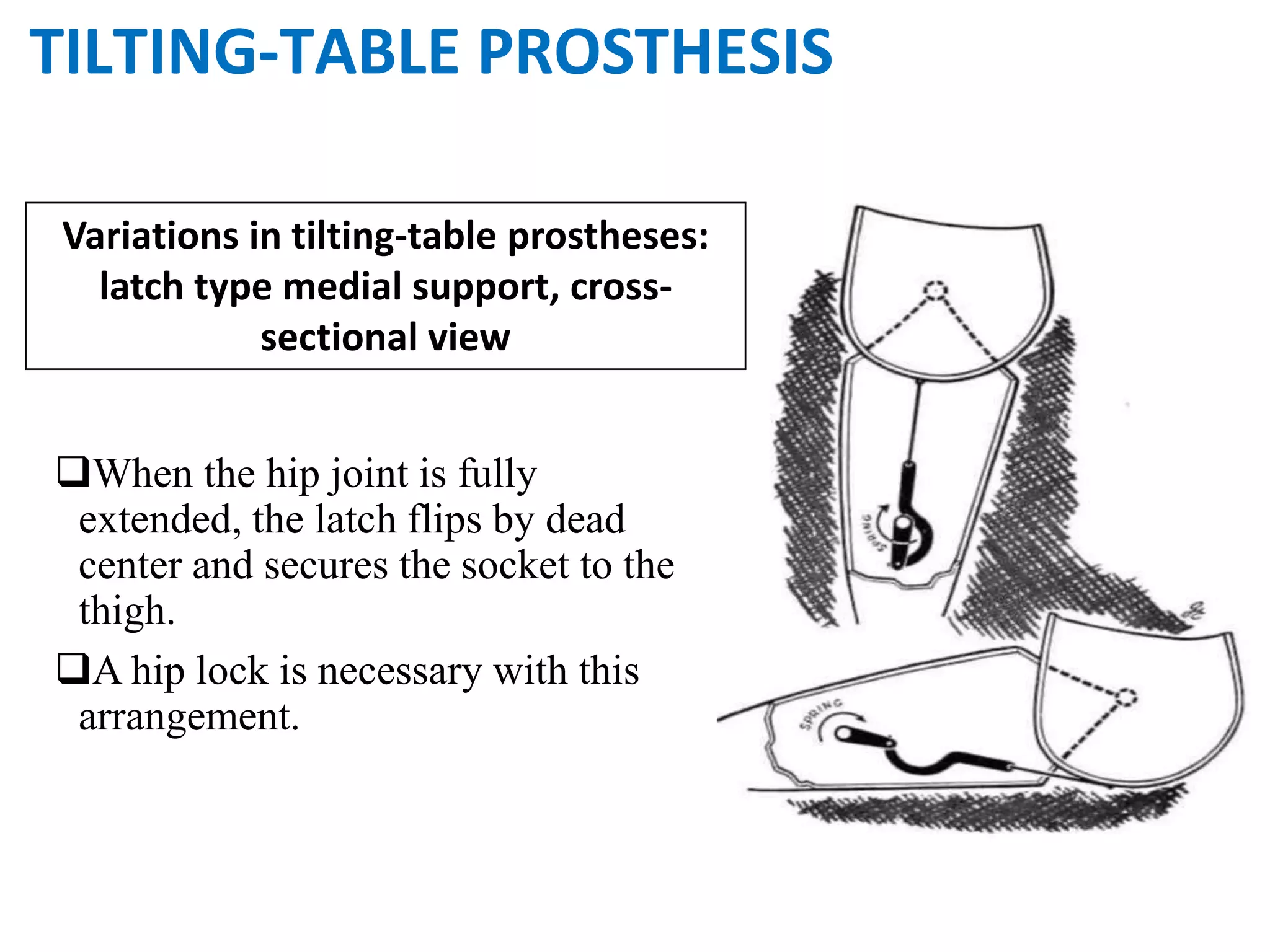 HIP DISARTICULATION | PPTX