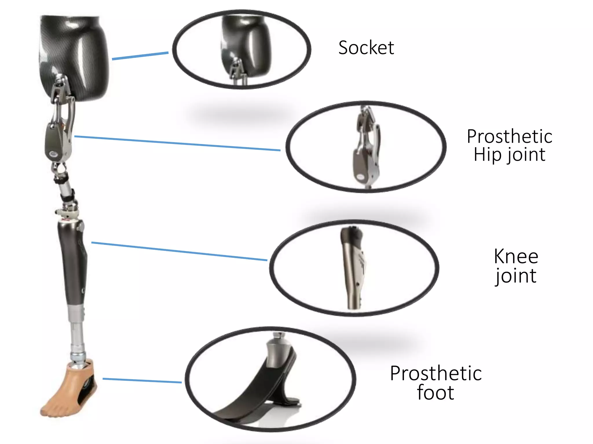 HIP DISARTICULATION | PPTX