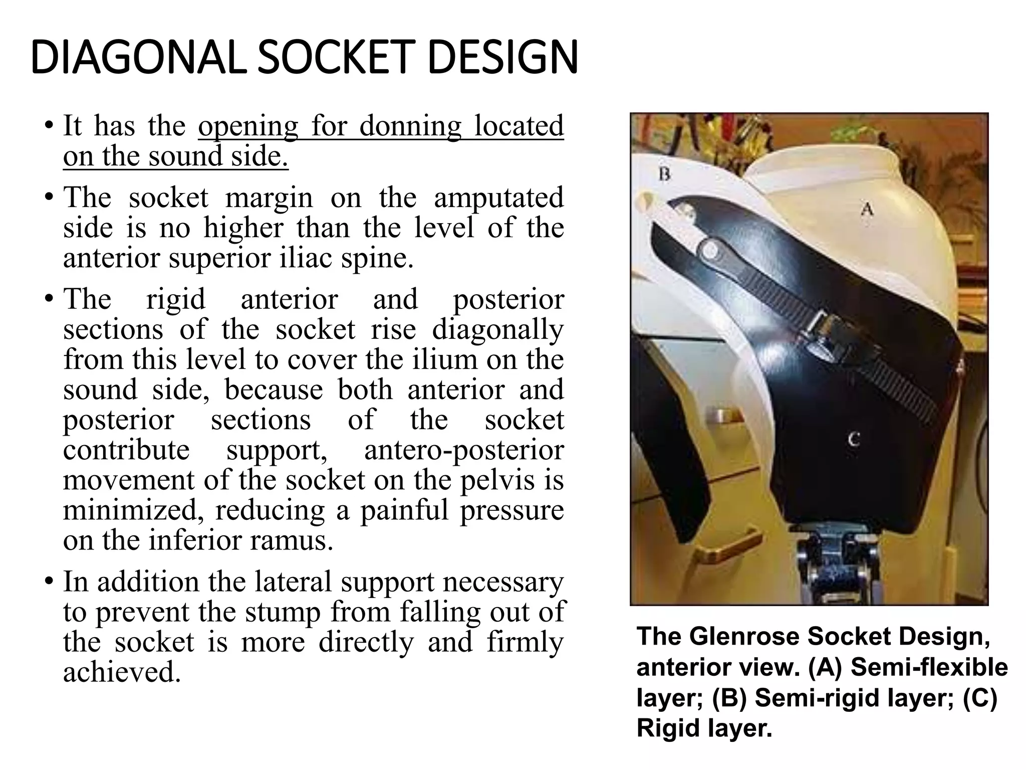 HIP DISARTICULATION | PPTX