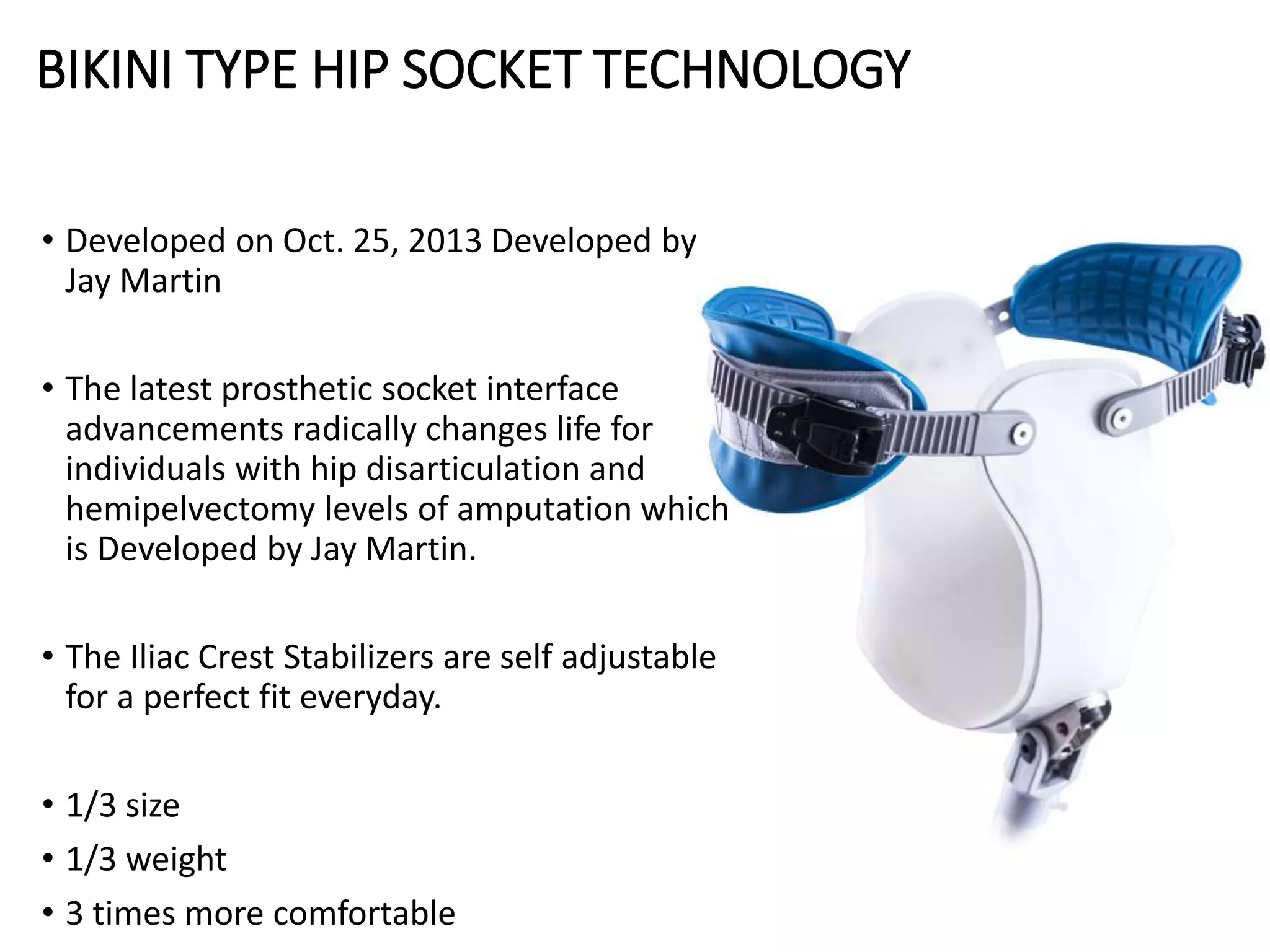 HIP DISARTICULATION | PPTX