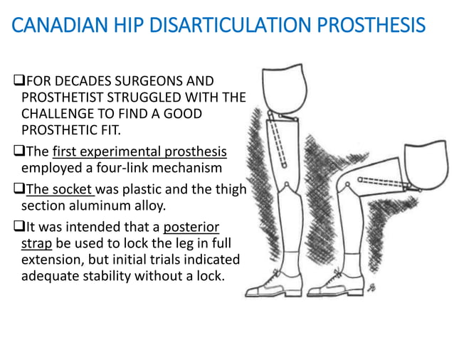 HIP DISARTICULATION | PPTX
