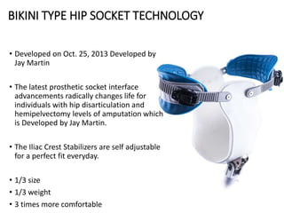HIP DISARTICULATION | PPTX