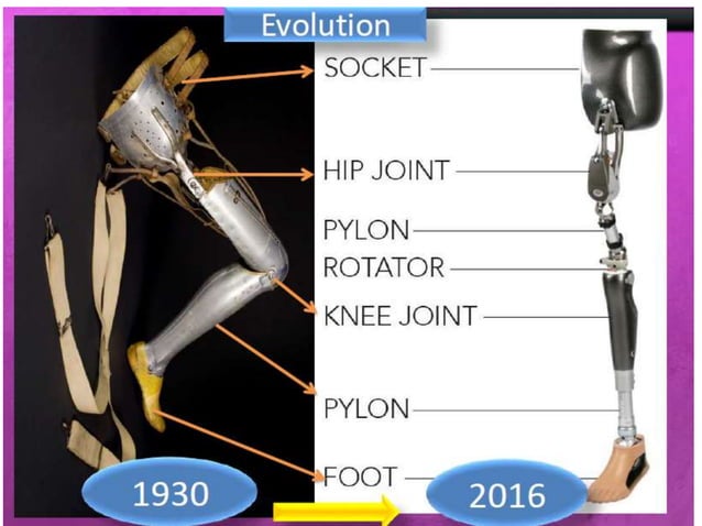 HIP DISARTICULATION | PPTX