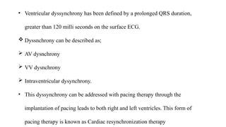 Cardiac resynchronization therapy. Ppt | PPTX