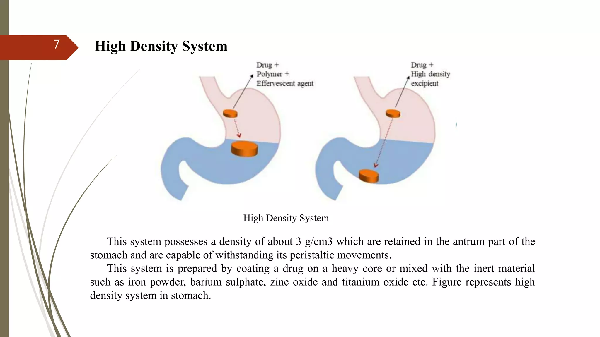 Approaches Of Gastro-Retentive Drug Delivery System or GRDDS | PPTX