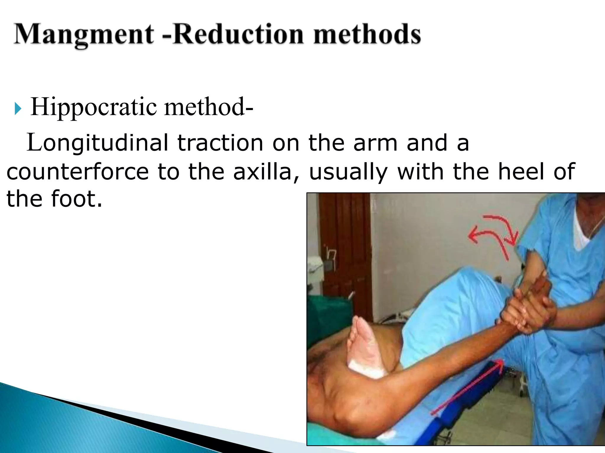 shoulder dislocation orthopedics + glenohumeral dislocation and ...