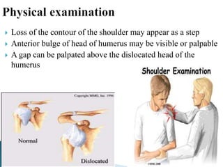 shoulder dislocation orthopedics + glenohumeral dislocation and ...