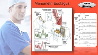 Aksi achalasia esofagus | PPTX
