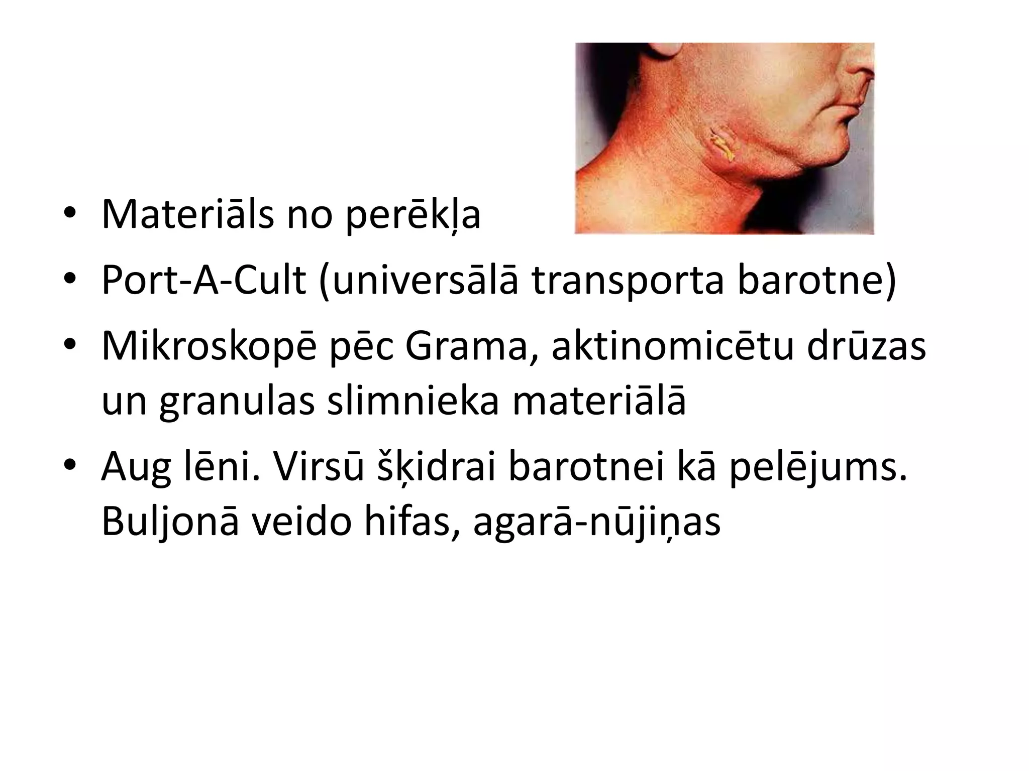 Aktinomikozes mikrobioloģiskā diagnostika (2) | PPTX