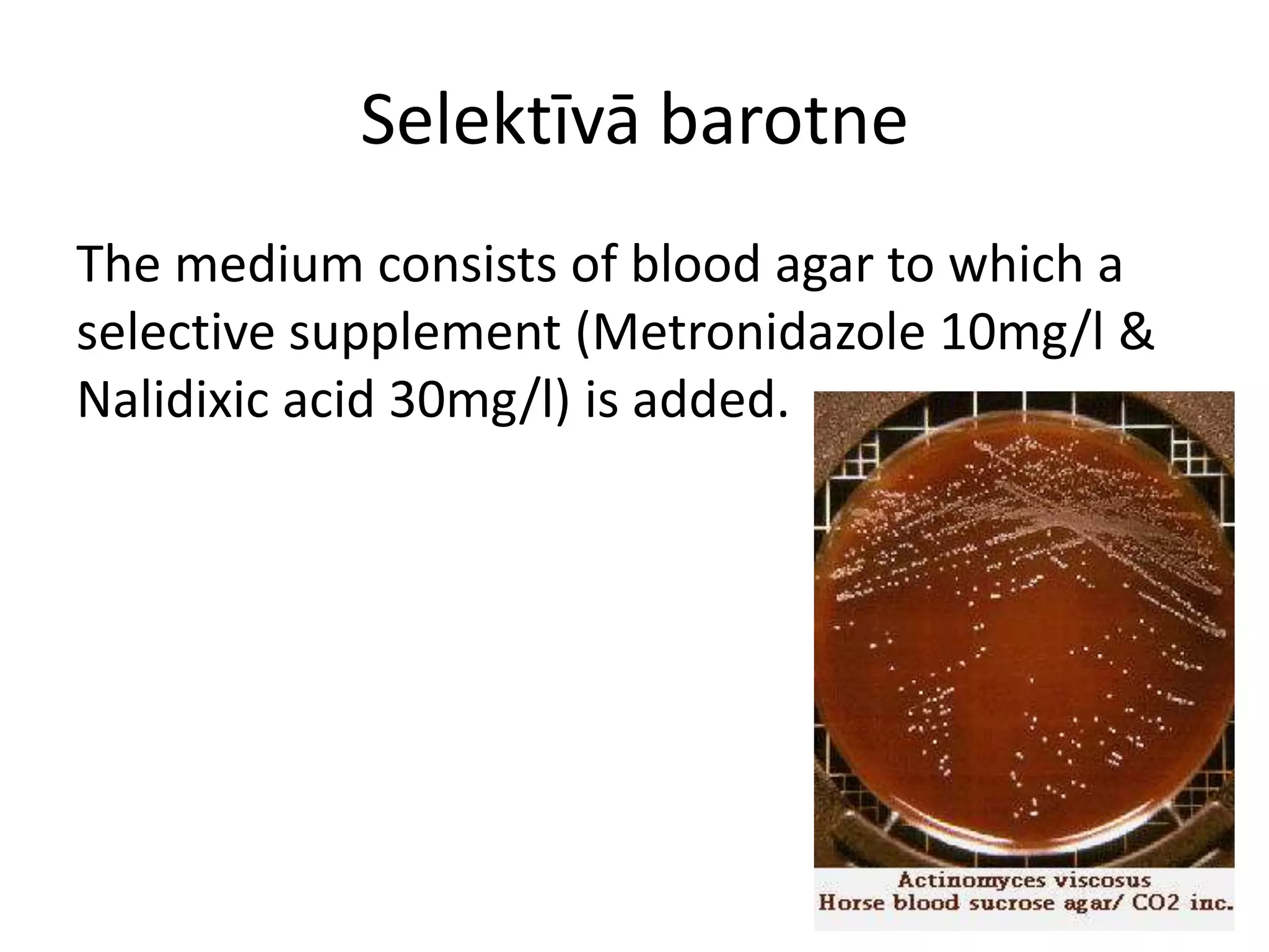 Aktinomikozes mikrobioloģiskā diagnostika (2) | PPTX
