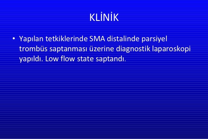 Akut mezenter iskemi