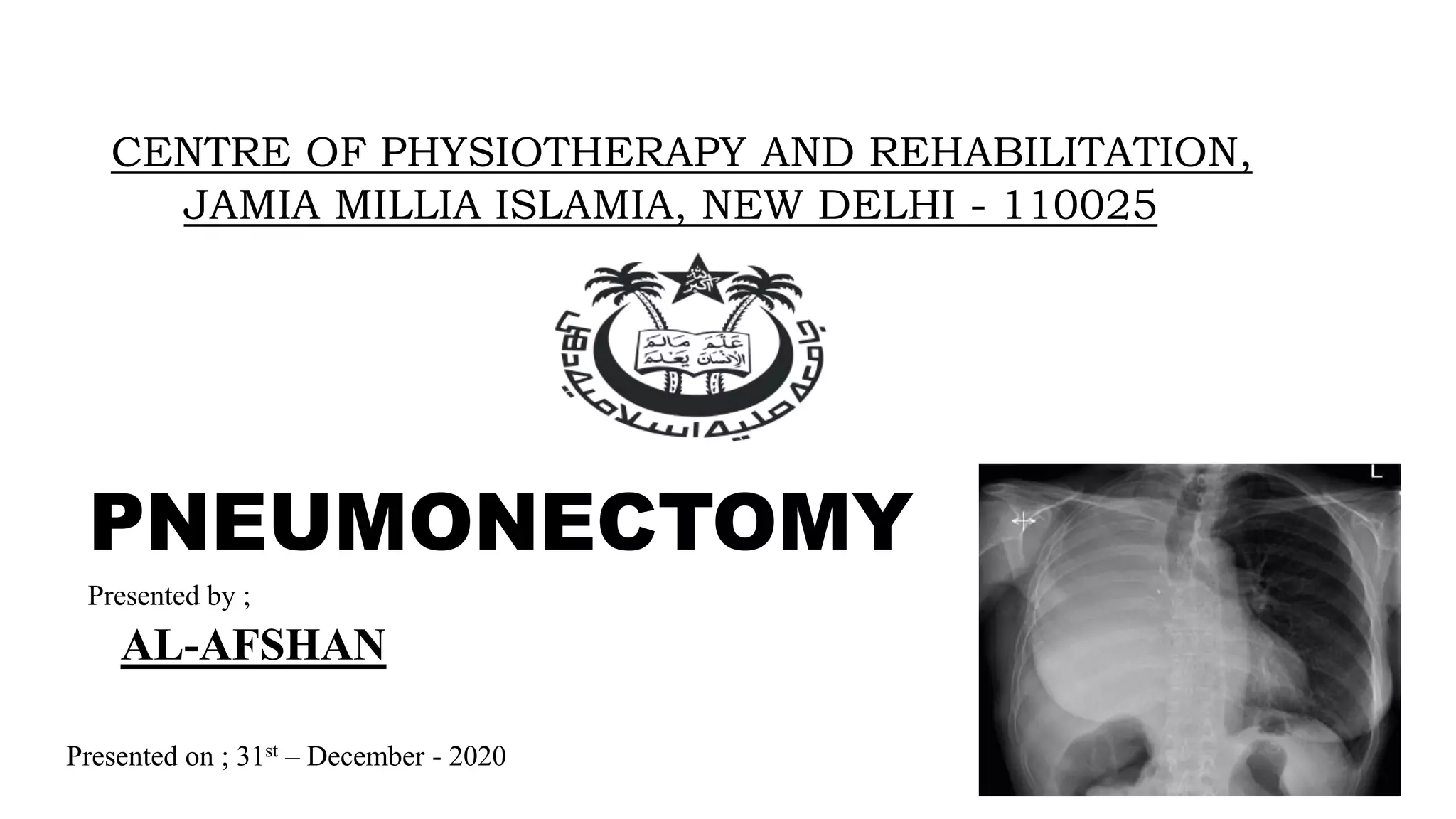 pneumonectomy | PPTX