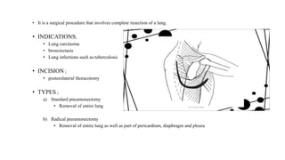 pneumonectomy | PPTX