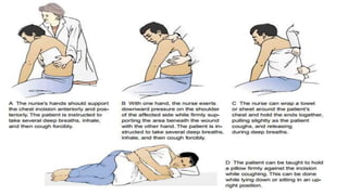 pneumonectomy | PPTX
