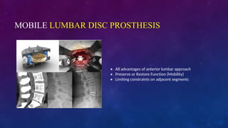 Anterior Lumbar Approach & Lumbar Disc Prosthesis LEFLOT J-L | PDF