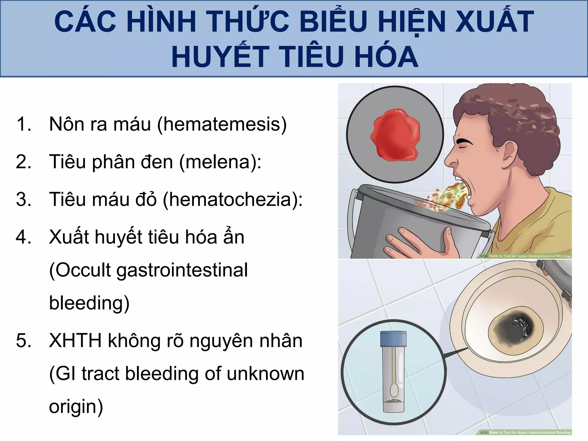 Tiếp cận chẩn đoán xuất huyết tiêu hoá.pdf