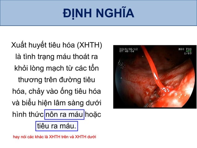 Tiếp cận chẩn đoán xuất huyết tiêu hoá.pdf