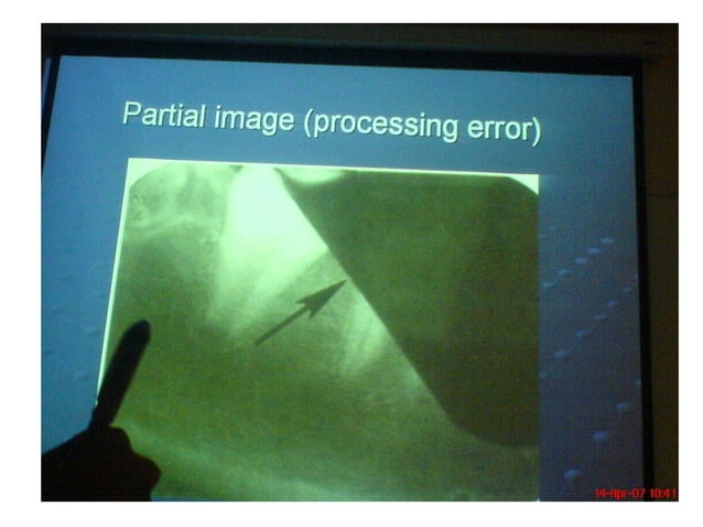 Analysis of Errors and Artifacts | PPT
