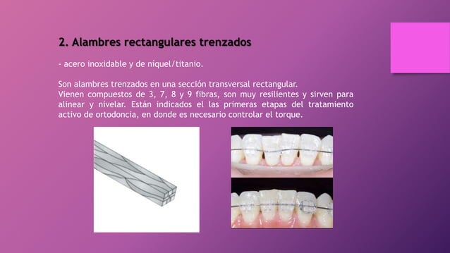 Alambres en ortodoncia.pptx