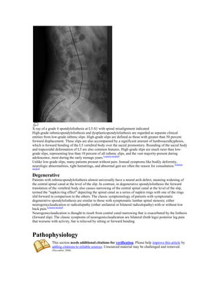Alan moelleken-md-santa-barbara-spondylolisthesis | DOCX