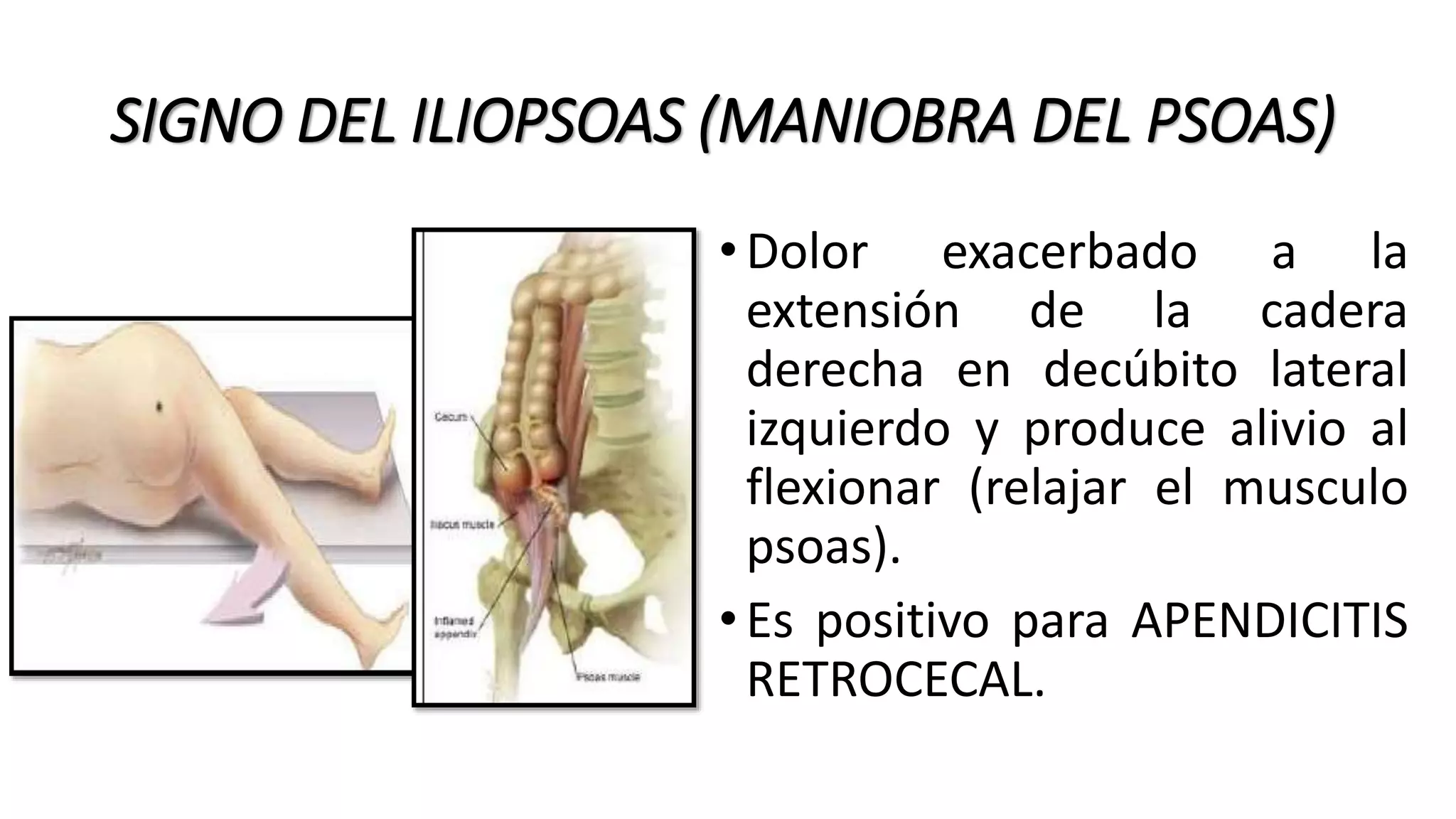 signos para la identificacion del dolor abdominal en la palpación | PPTX
