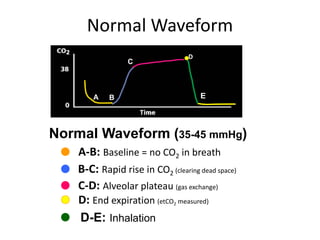Alarms waves capnography | PPTX