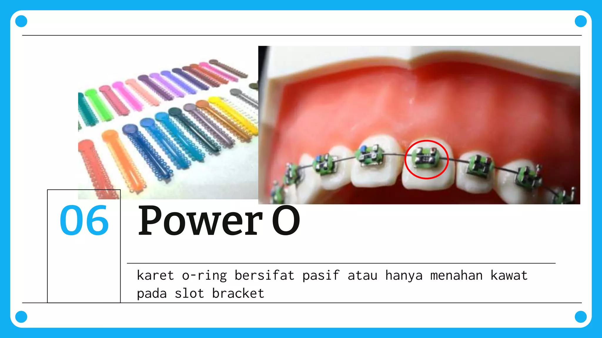 Alat dan Bahan Ortodonsi erryska.pptx