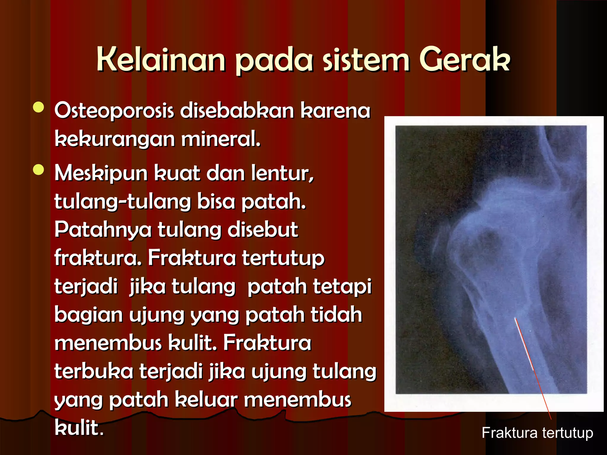 Alat gerak manusia | PPT