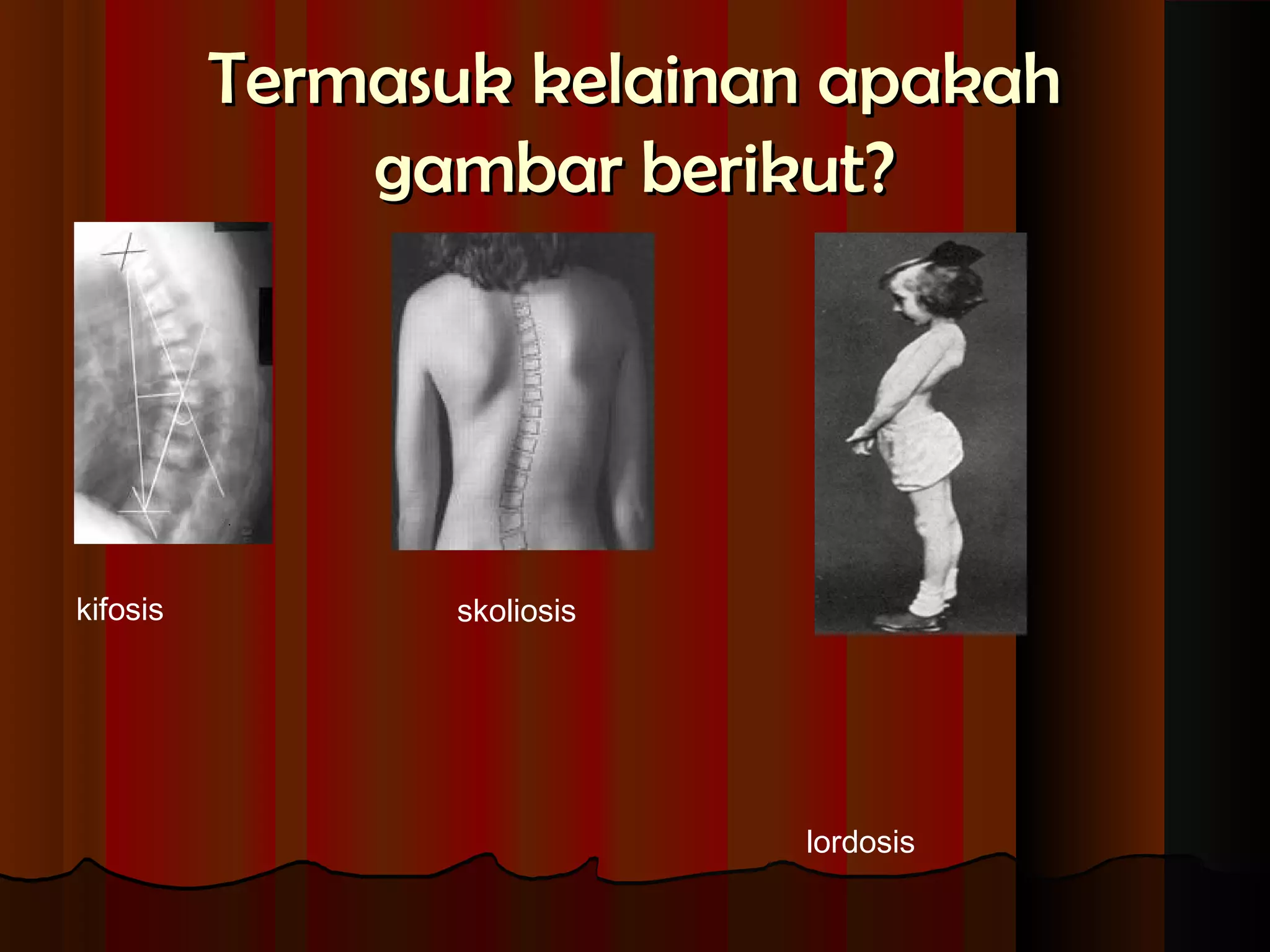 Alat gerak manusia | PPT