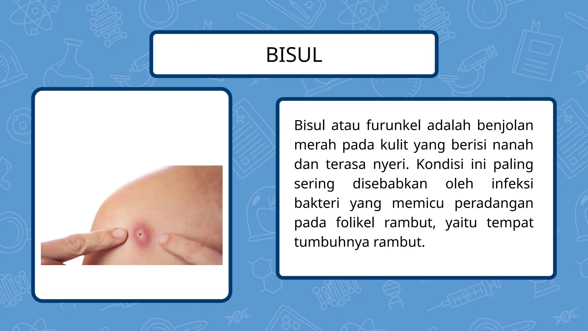 TUGAS PPT ALAT INDRA KULIT PADA MANUSIA. | PPTX