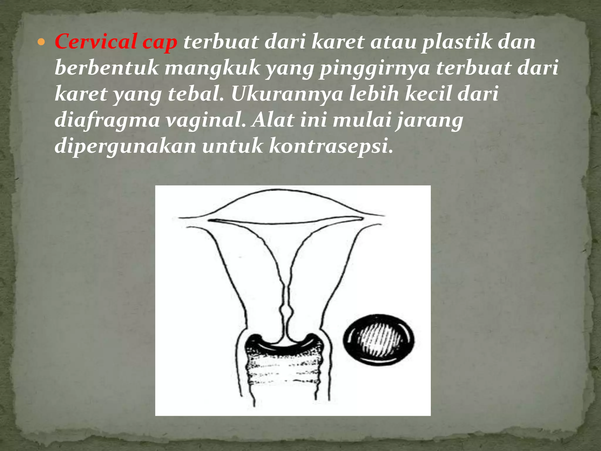 Alat kontrasepsi | PPTX