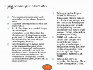 Alat kontrasepsi dalam rahim STIKES MUHAMMADIYAH KUDUS NISA | PPTX