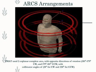 Alawi treatment planning-evaluation-of-volumetric-modulated-arc-therapy ...