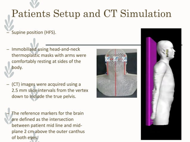 Alawi treatment planning-evaluation-of-volumetric-modulated-arc-therapy ...