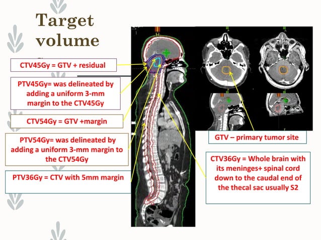 Alawi treatment planning-evaluation-of-volumetric-modulated-arc-therapy ...