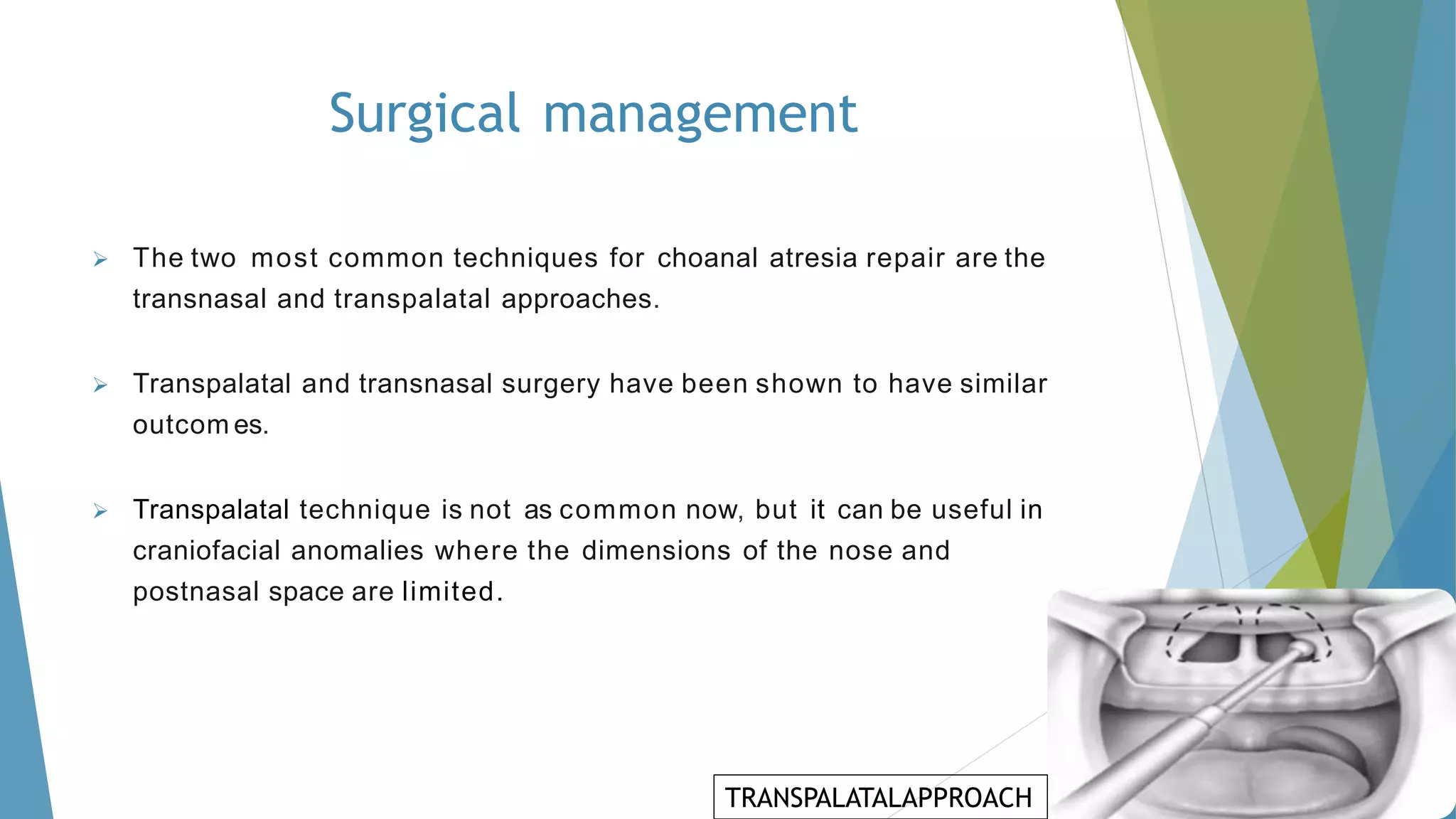 Congenital nasal obstruction | PPTX