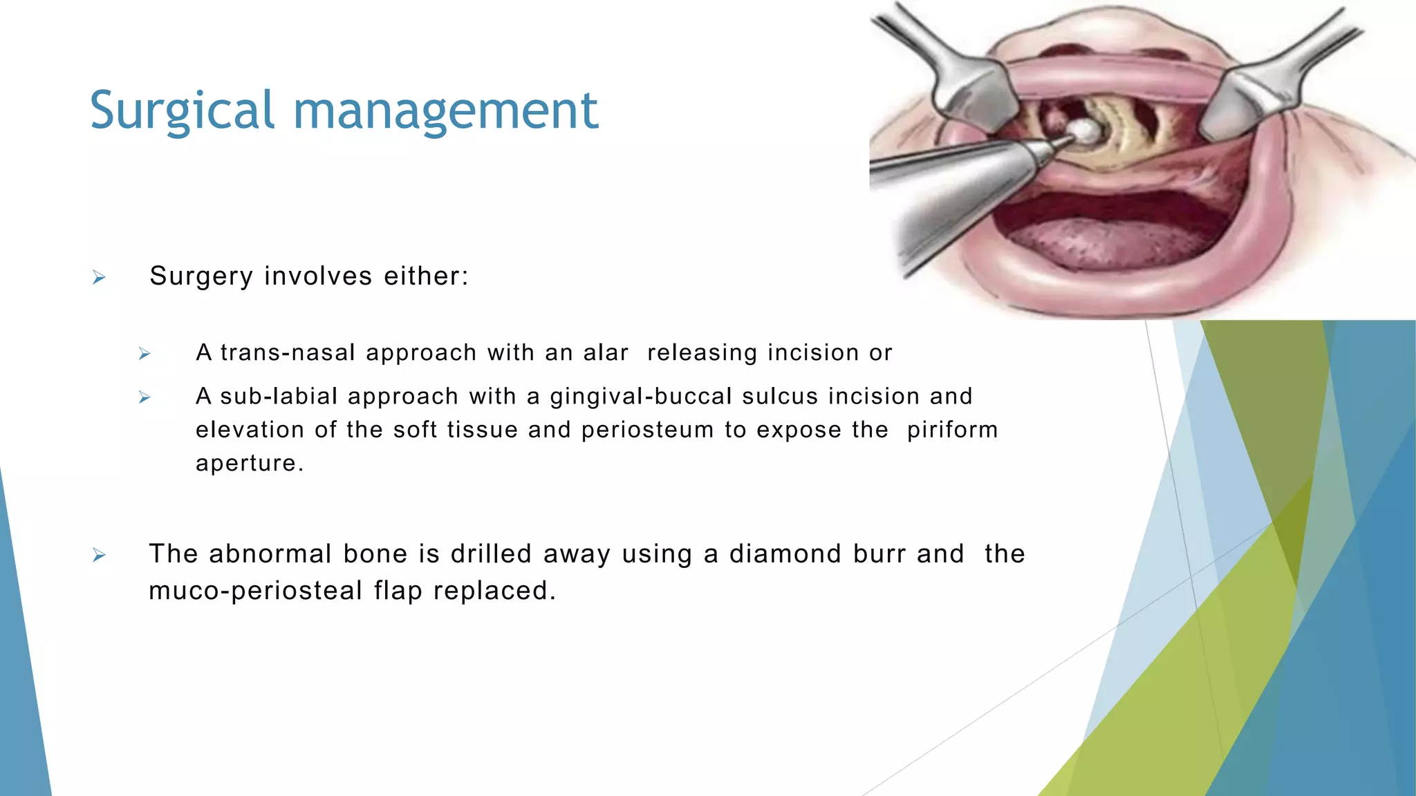 Congenital nasal obstruction | PPTX