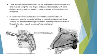 Congenital nasal obstruction | PPTX